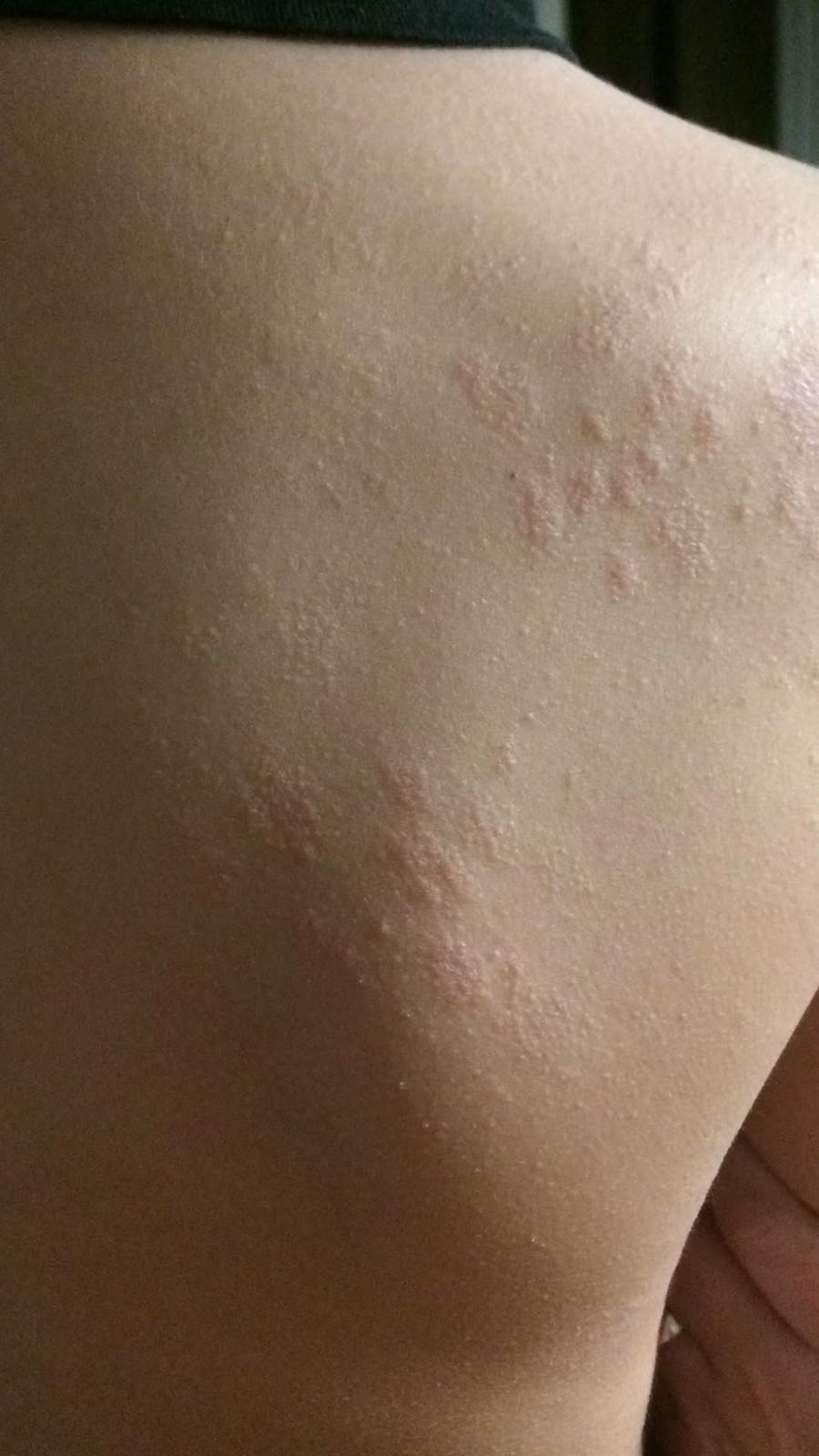 Svrab? - Modrý koník