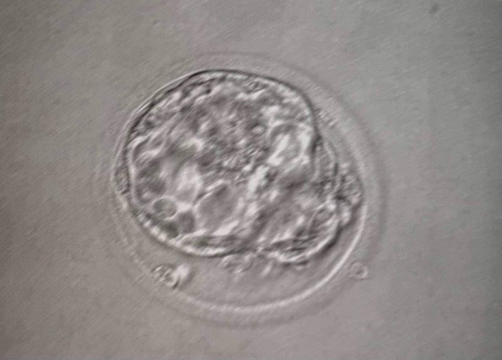 [Zodpovězené] Kvalita embrya. Lze posoudit z fotografie? - Modrý koník