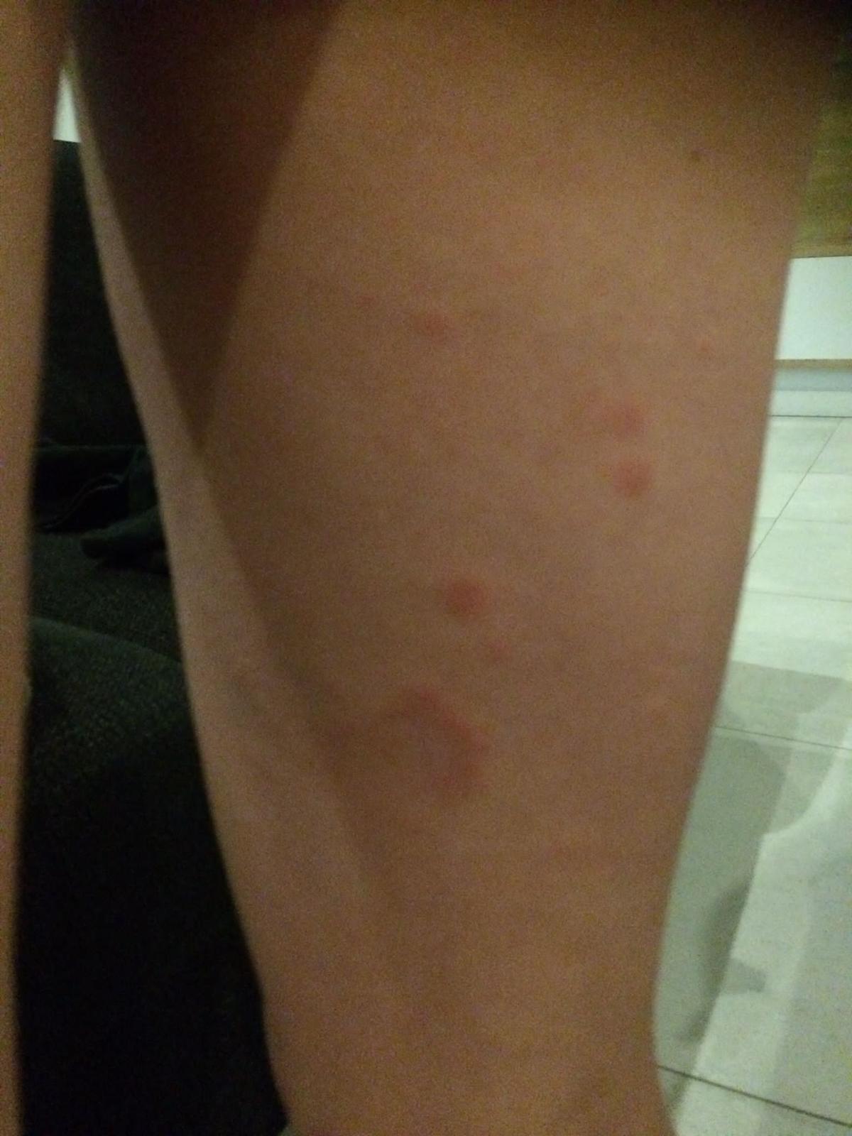 Svrab? - Modrý koník