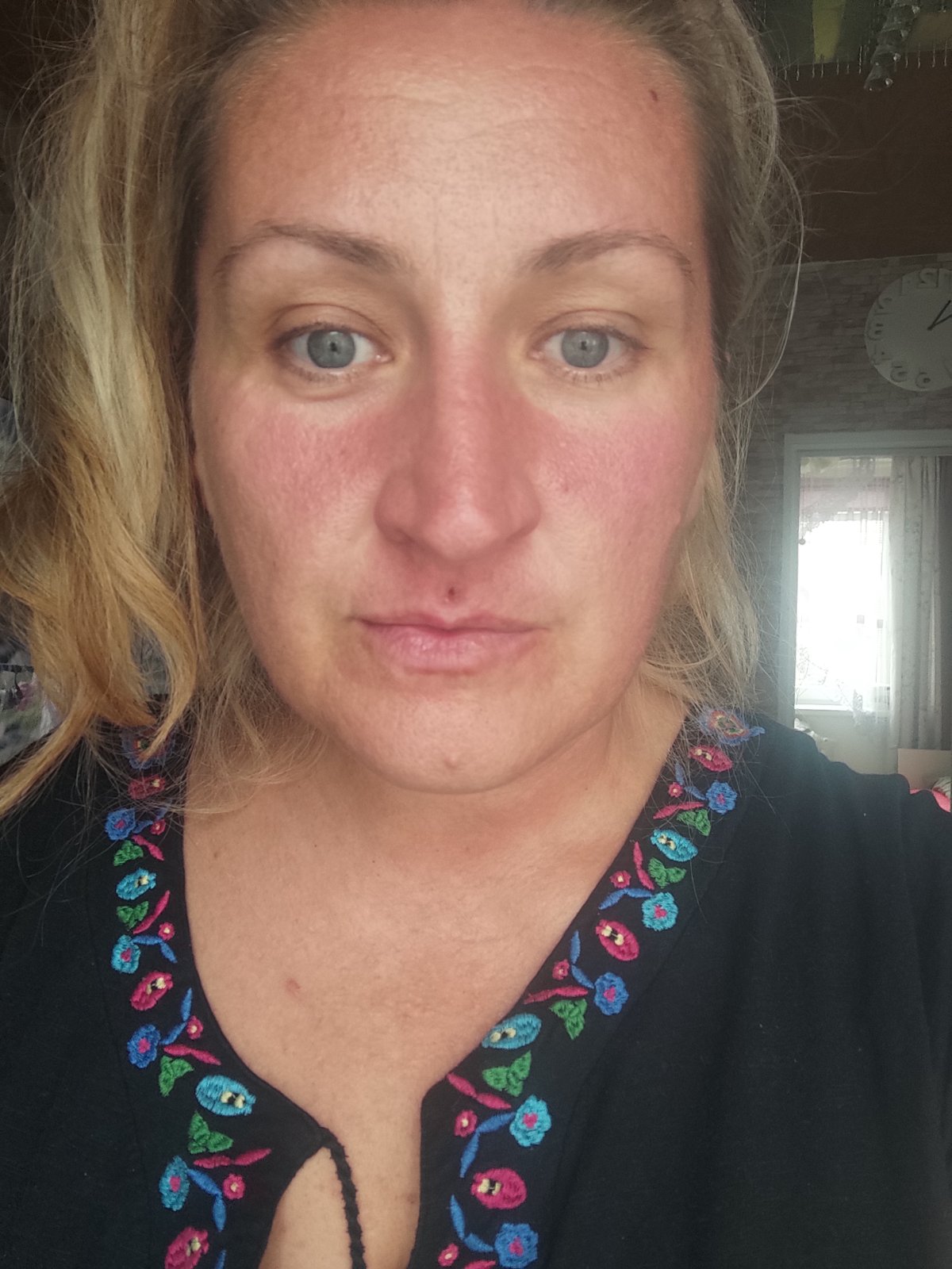 Je to 5. nemoc? - Modrý koník