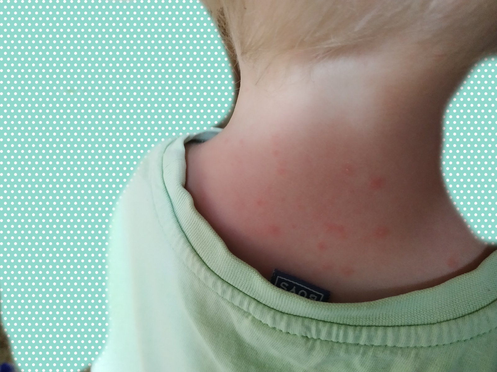 5. nebo 6. nemoc? - Modrý koník