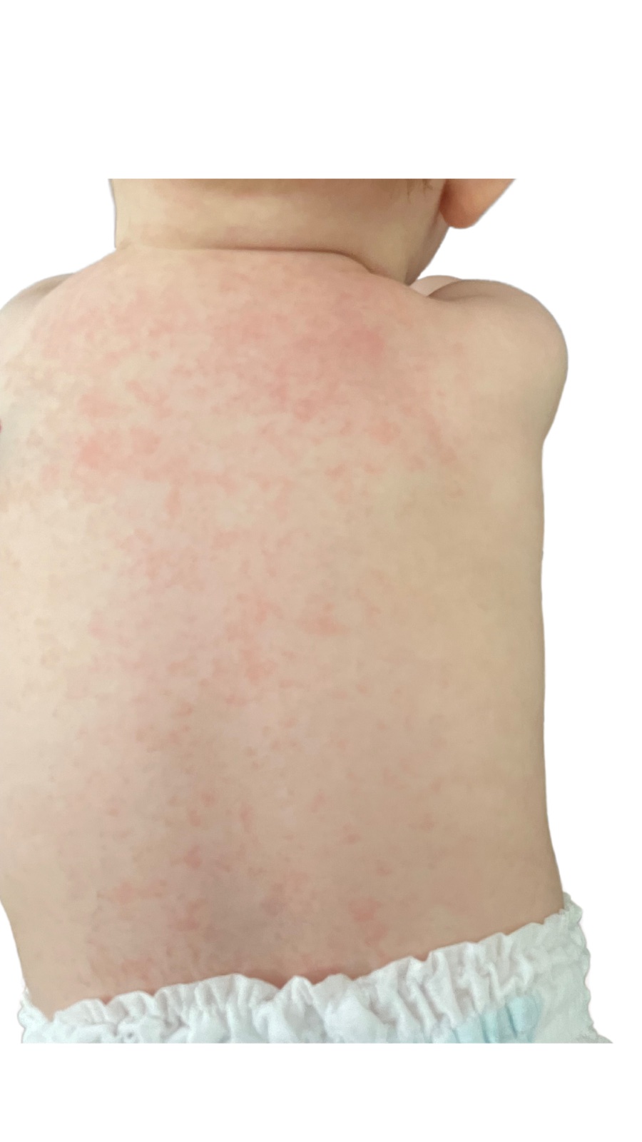 [Zodpovězené] Muže to být šestá nemoc? - Modrý koník