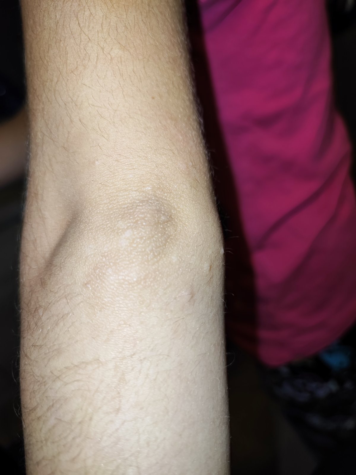 Svrab? - Modrý koník