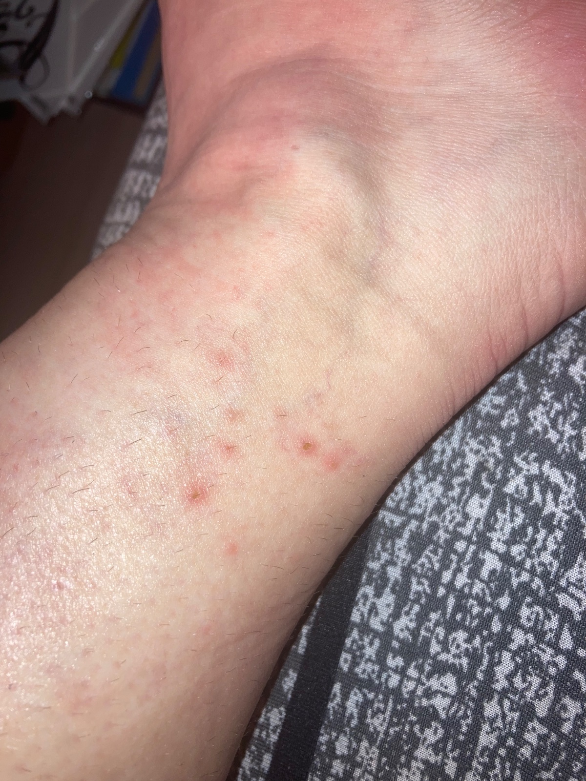 Svrab. Ano nebo ne? - Modrý koník